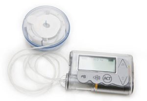 researchers trial artificial pancreas – Diabetes Roadmap